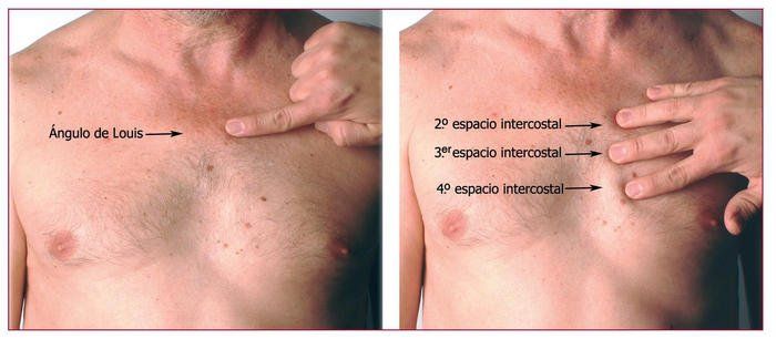 Electrocardiogram Electrodes | Where to place them?